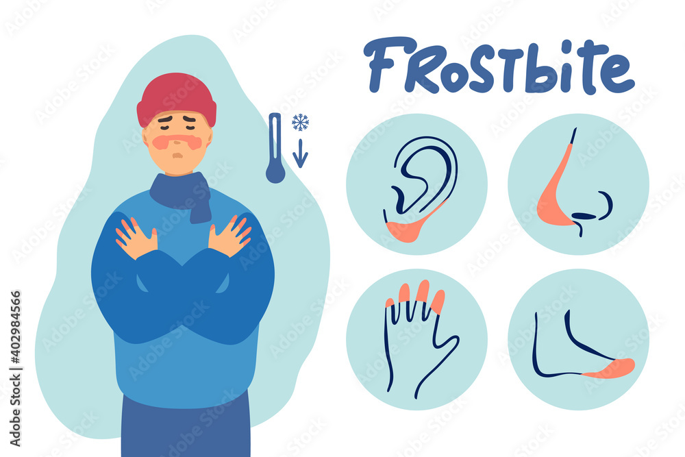 man froze. Frostbite concept banner. Cartoon illustration of frostbite ...