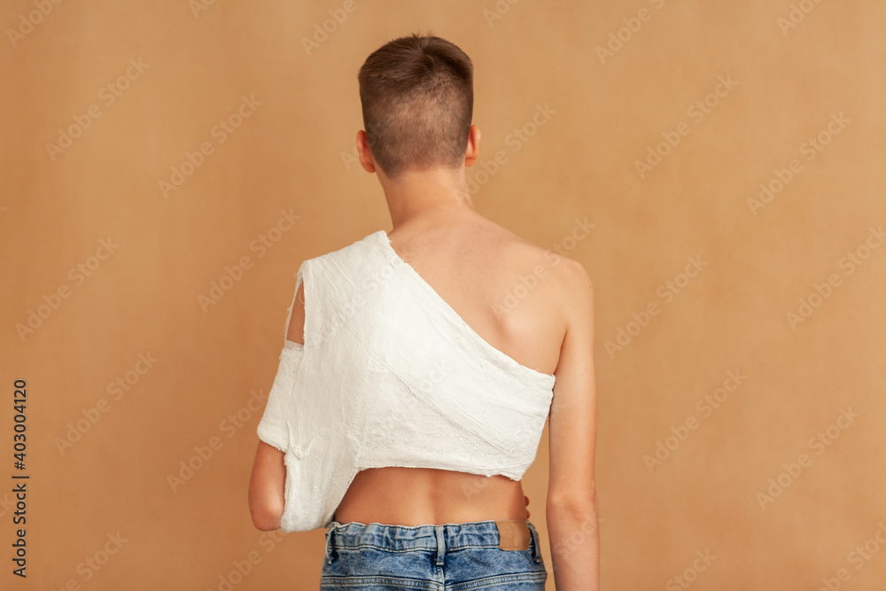Boy with broken clavicle on beige background. Young man wears a plaster ...