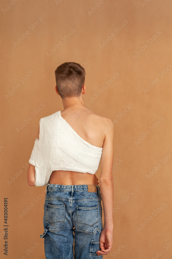 Broken Clavicle Cast