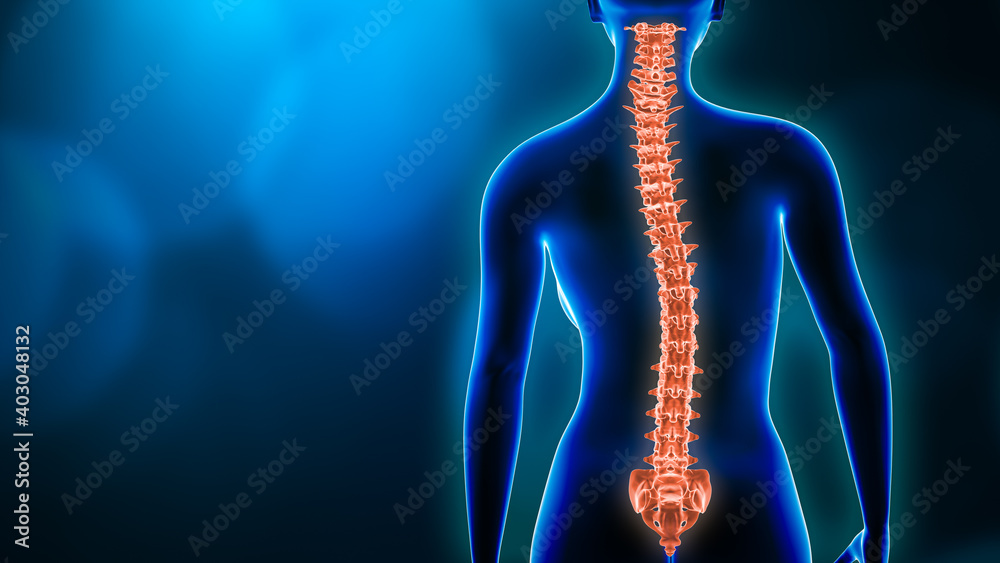 Curvature of the spine and woman body back view 3D rendering ...