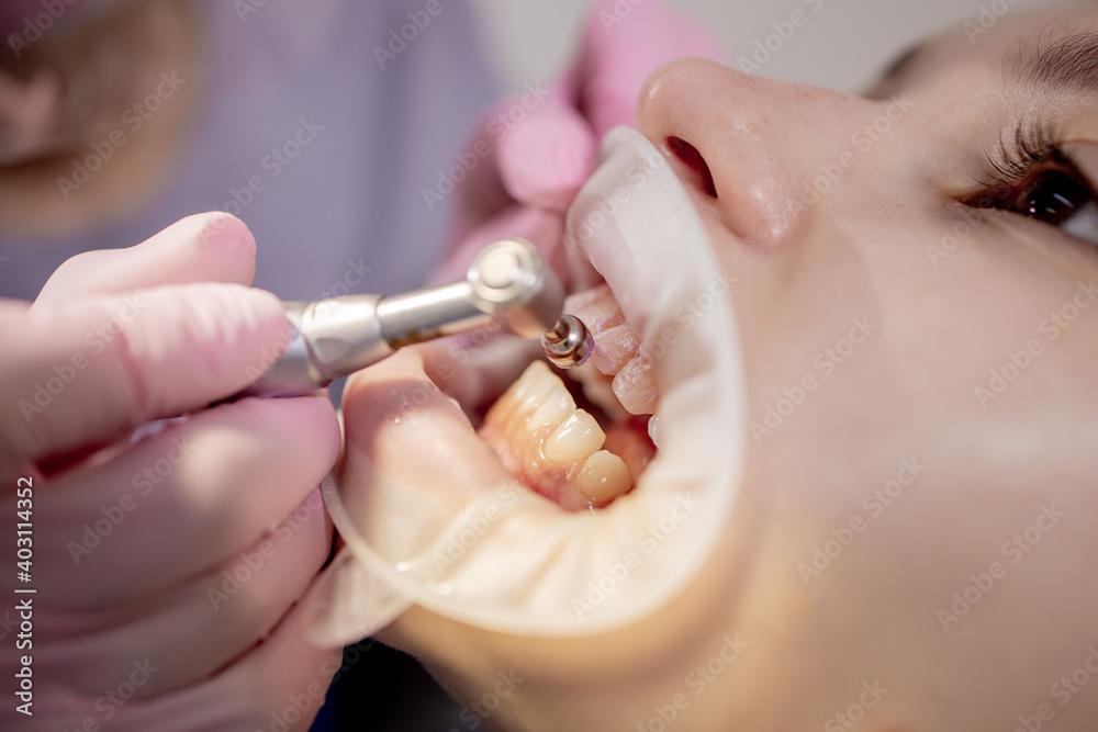 Dentist making professional teeth cleaning female young patient at the ...