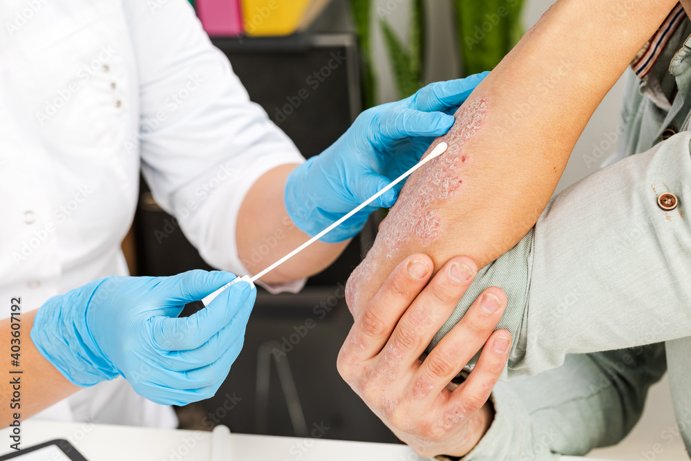 A dermatologist takes a skin analysis of a sick patient. Examination ...