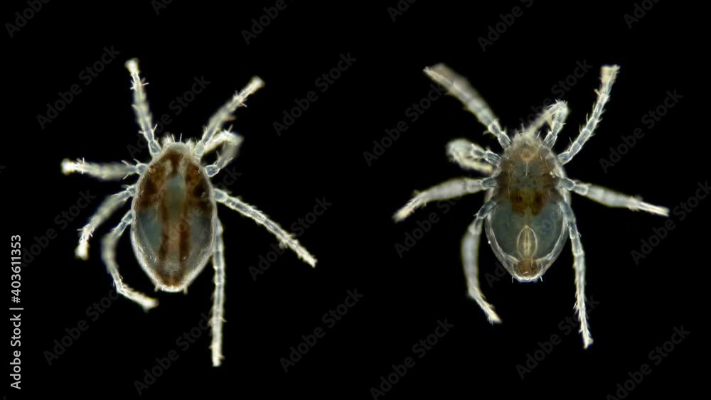 Suborder Prostigmata Acari (mite) under a microscope. Perm Territory ...