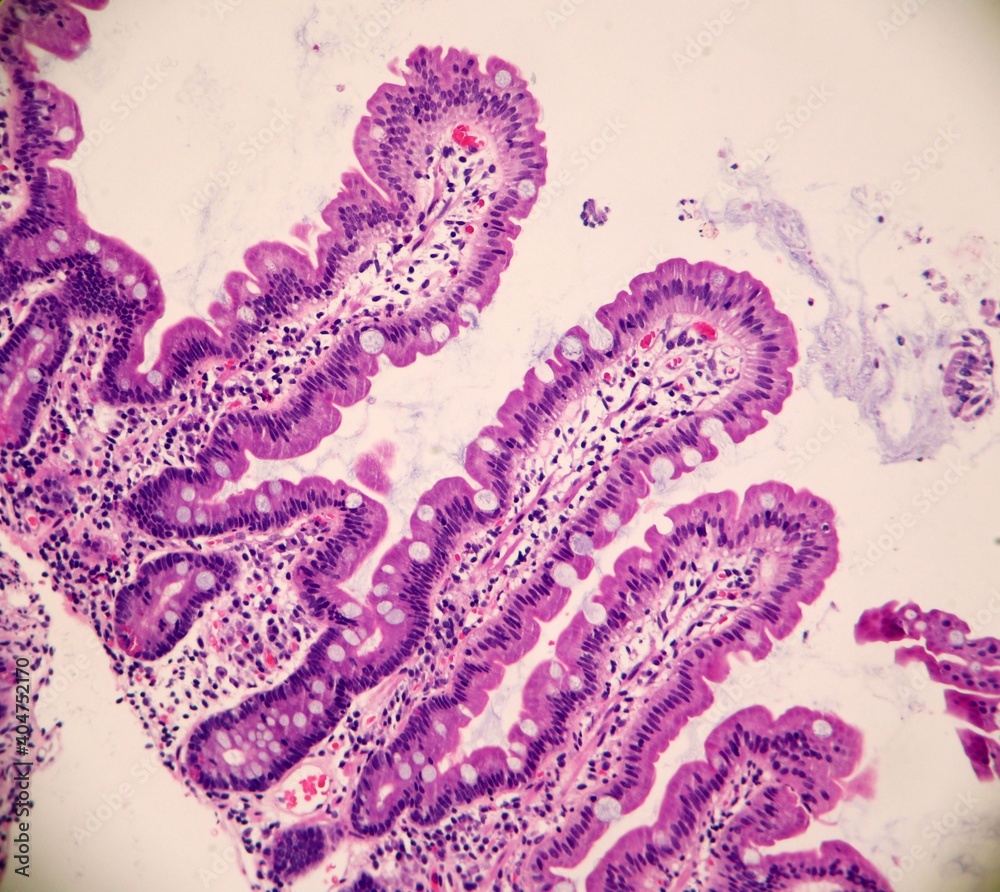 Poster Normal duodenum mucosa showing long, slender villi – Wall Art ...