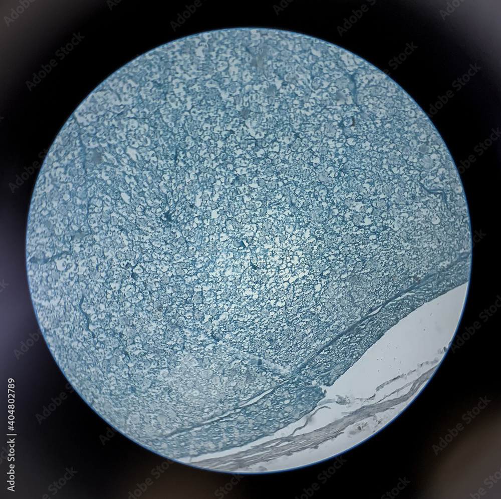 microbiology big nerve cells of spinal cord under microscope Stock ...