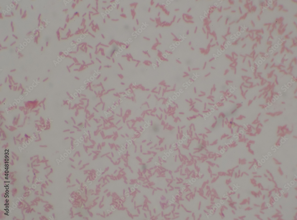 Gram negative bacilli with bipolar stain bacteria.Burkholderia ...