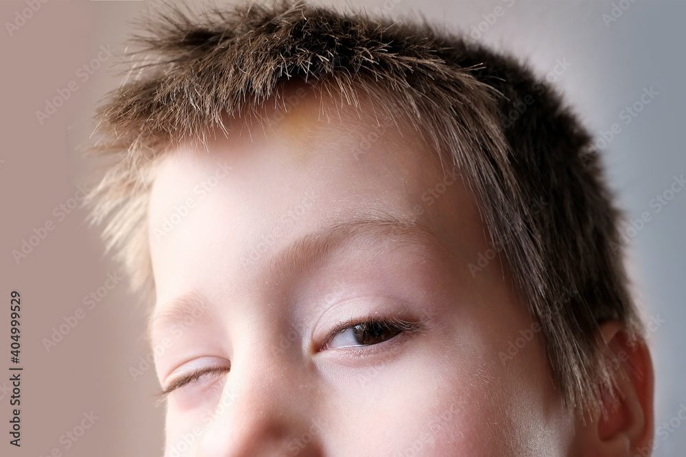 boy, kid, part of the face, funny eyes close up, looking to the side ...