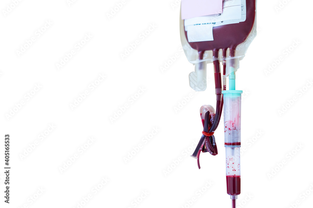 blood bag with filter and drip chamber tube for transfusion to patient ...