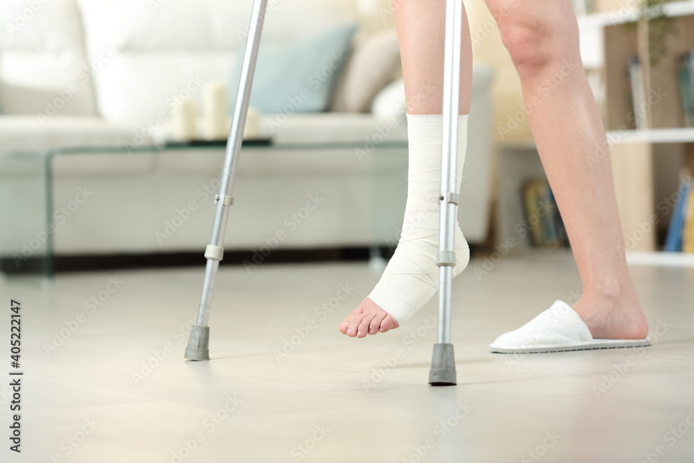 Disabled woman with bandaged foot walks with crutches Stock Photo ...