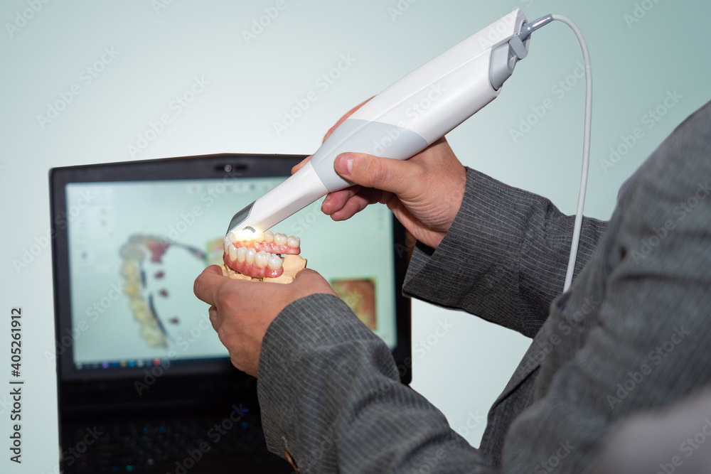 Dental intraoral scanner in hands of a man. Snapshot from a scaner is ...