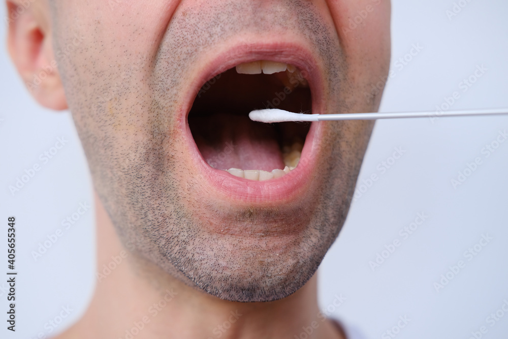 lab assistant takes man’s saliva sample from his mouth for DNA analysis ...