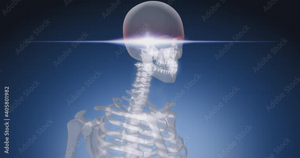 Human skeleton, bone scan, joint, medical screen, human anatomy ...