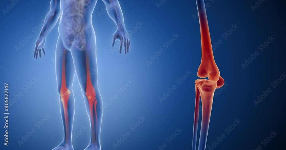 Knee, patella bone x-ray style, internal organs 3D render, anatomy of ...