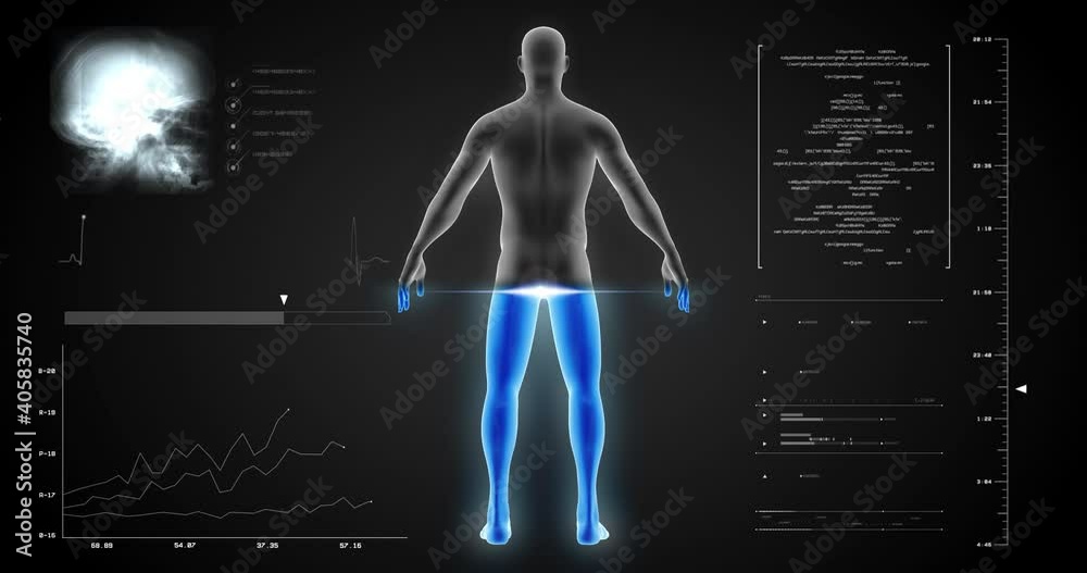 3D human body scan, body scanner, medical screen, tomography, medical ...