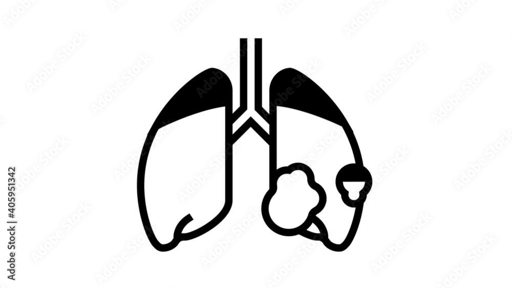 acute respiratory distress syndrome animated black icon. acute ...