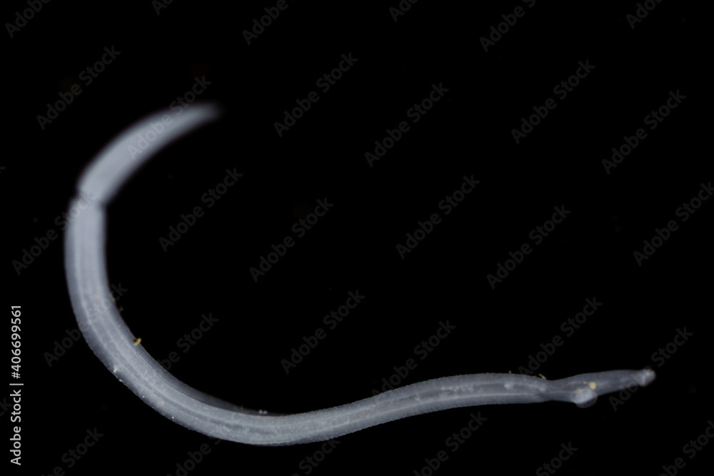 Schistosoma is a genus of trematodes, commonly known as blood flukes ...
