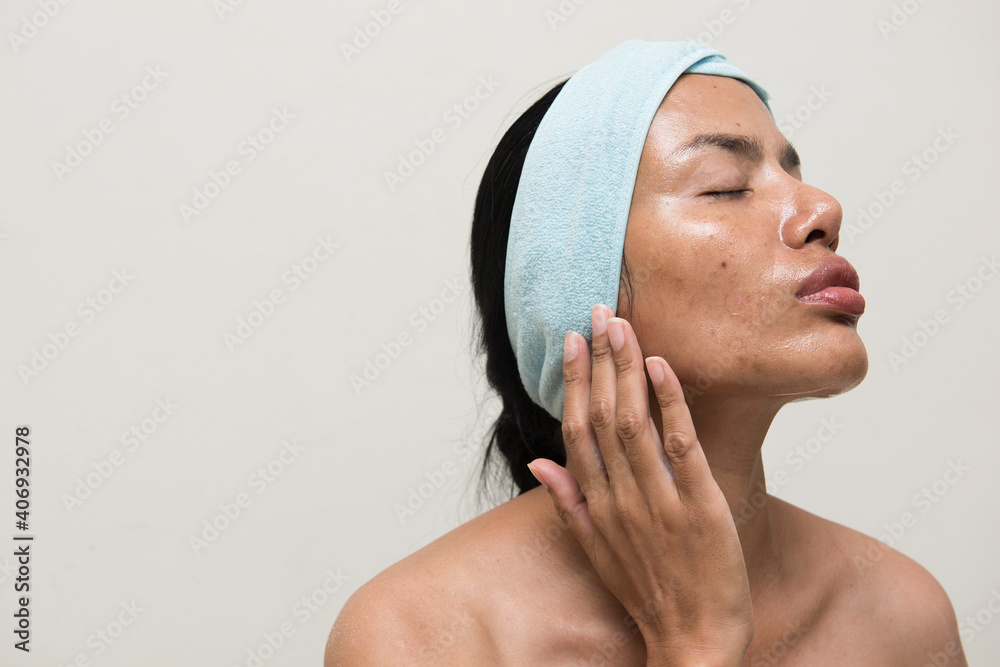 woman with very oily skin Stock Photo | Adobe Stock