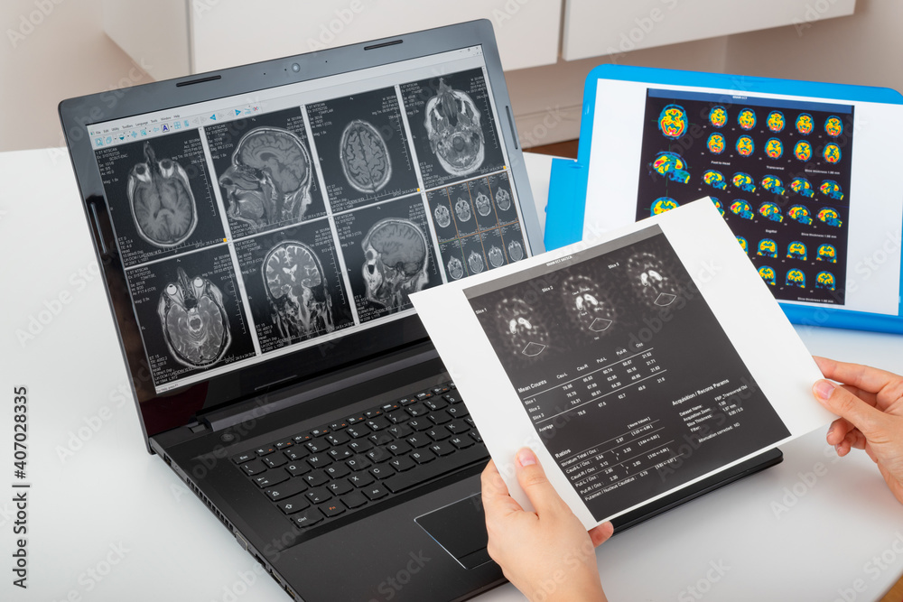 Neurology student while studying and consulting different medical ...