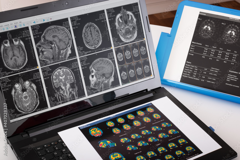 Neurology student while studying and consulting different medical ...