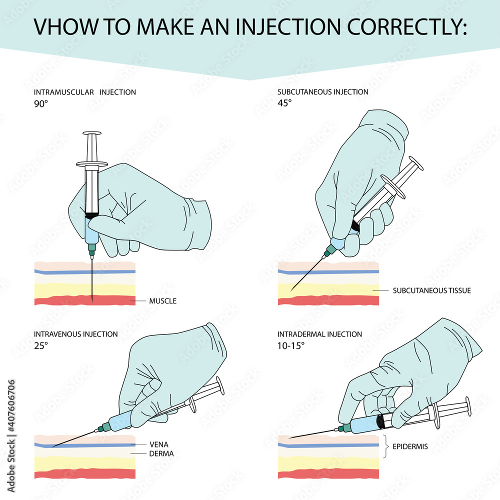 How to make an injection correctly. Infographics for different types of ...