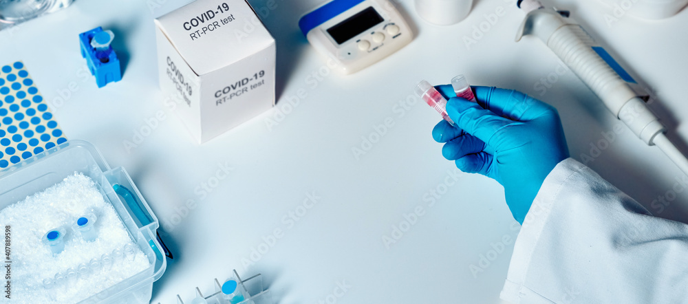 Novel coronavirus 2019 nCoV pcr diagnostics kit. This is RT-PCR kit to ...