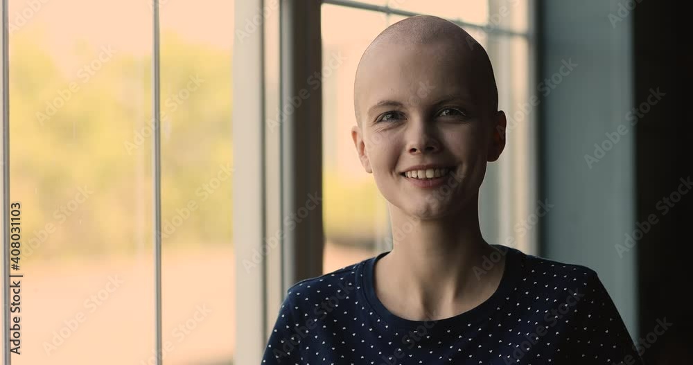 Head shot portrait bald attractive female cancer patient standing near ...