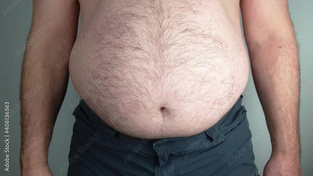 An overweight man cannot hold in his stomach anymore. Bulging belly ...