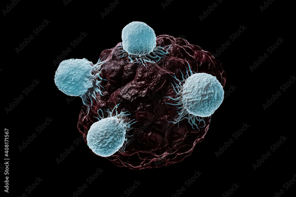 White blood cells, T lymphocytes or natural killer T attack a cancerous ...