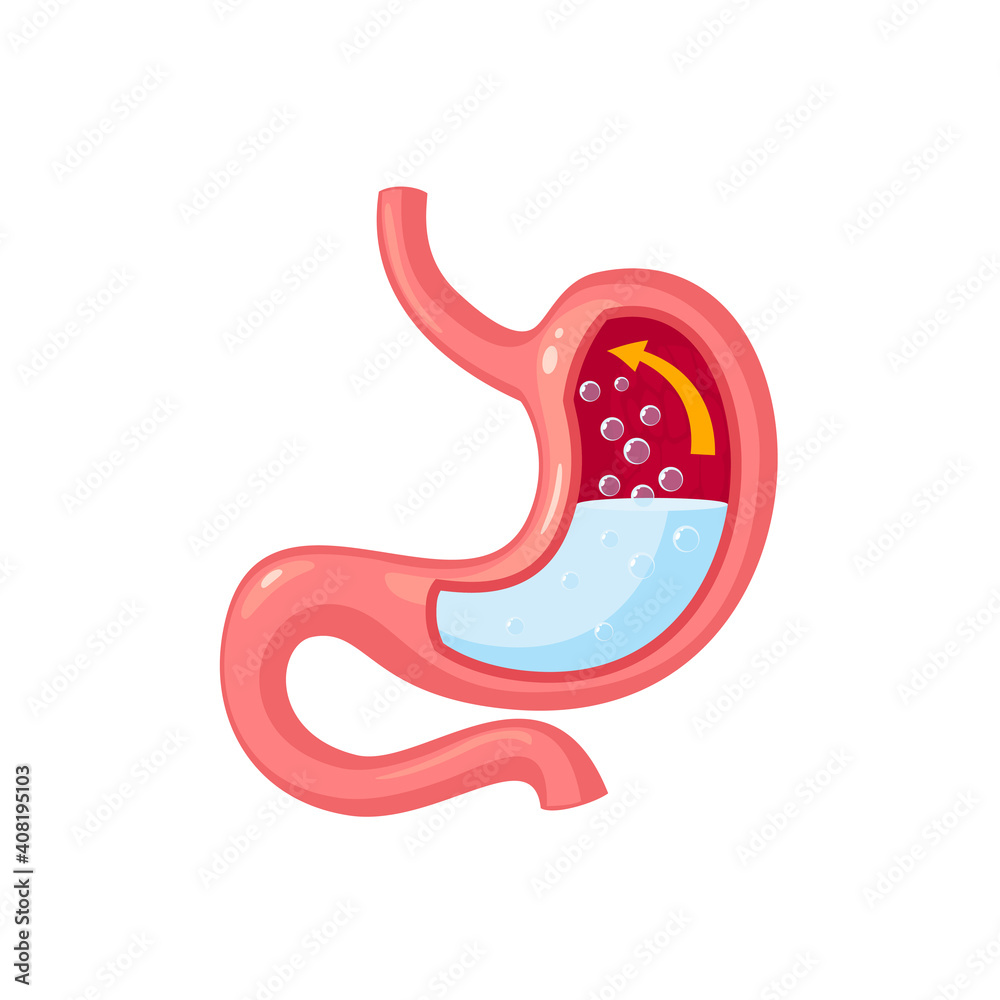 Belching gas human stomach. Internal organ, anatomy. Vector cartoon ... Belching gas human stomach. Internal organ, anatomy. Vector cartoon ...