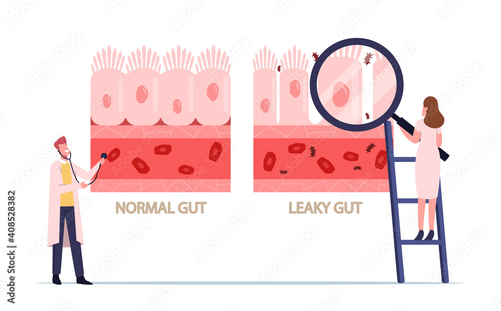 Comparison of Normal and Sick Gastrointestinal Tract Tissue, Leaky Gut ...