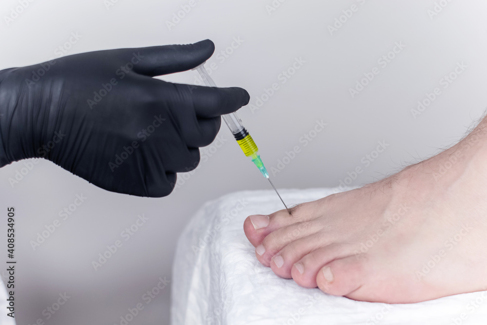 An orthopedic surgeon gives an injection in the finger joint. Treatment ...