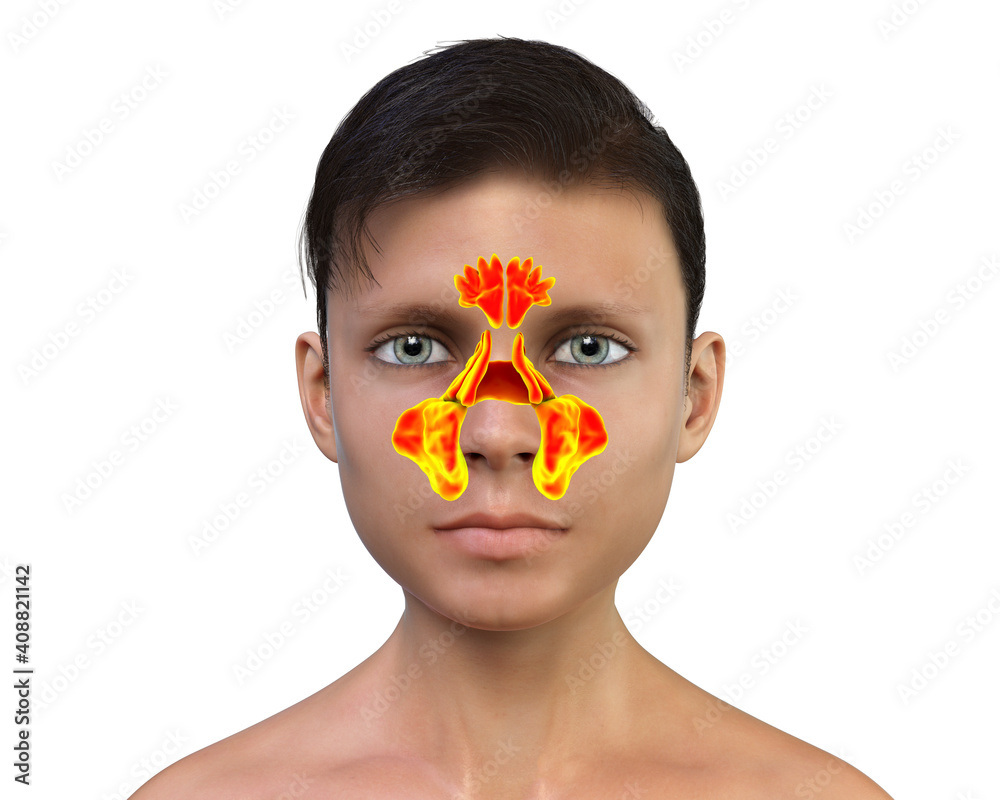 Anatomy of paranasal sinuses Stock Illustration | Adobe Stock