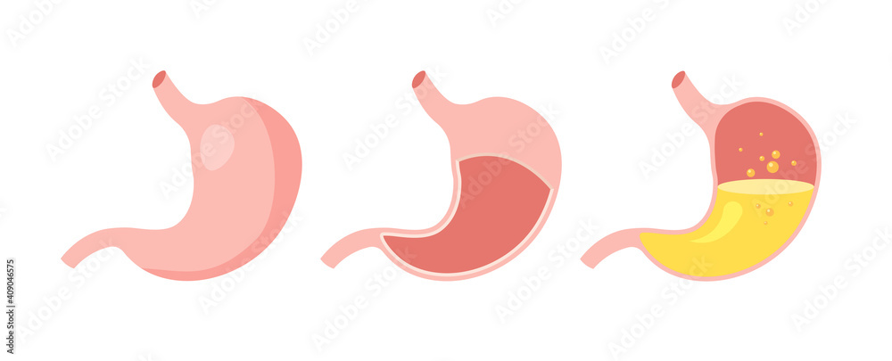 Healthy and unhealthy, empty and full human stomach in trendy flat ...