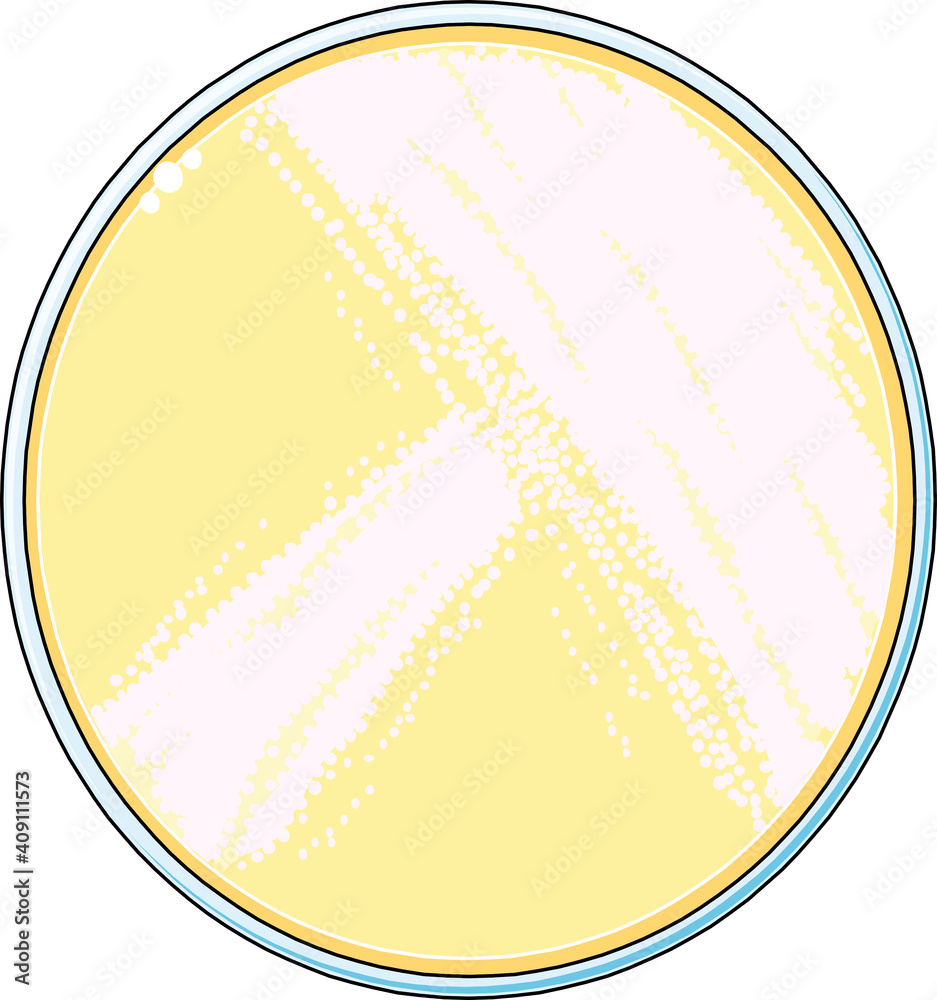 Top view of a Petri dish filled with nutrient agar media and growing ...