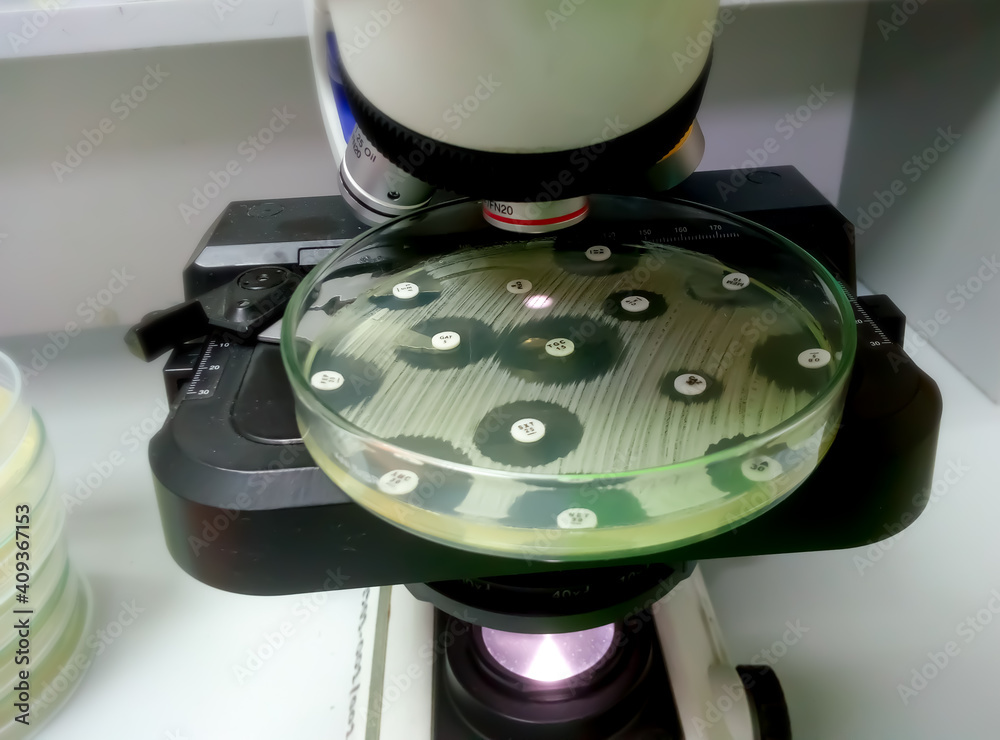 Petri dish with antibiotic susceptibility stands under microscope ...