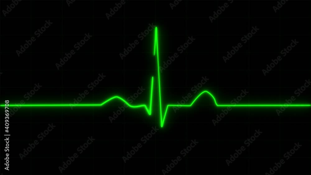 Concept 2-E1 Realistic heart pulse monitor animation on ...