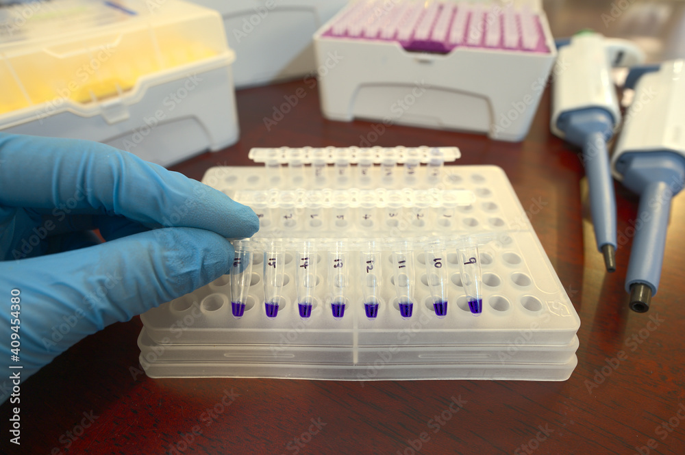 Strip tubes carrying PCR samples in a biotechnology scientific research ...