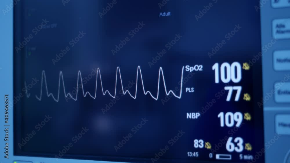 Heart rate monitor. Monitor screen registering pulse readouts. Monitor ...