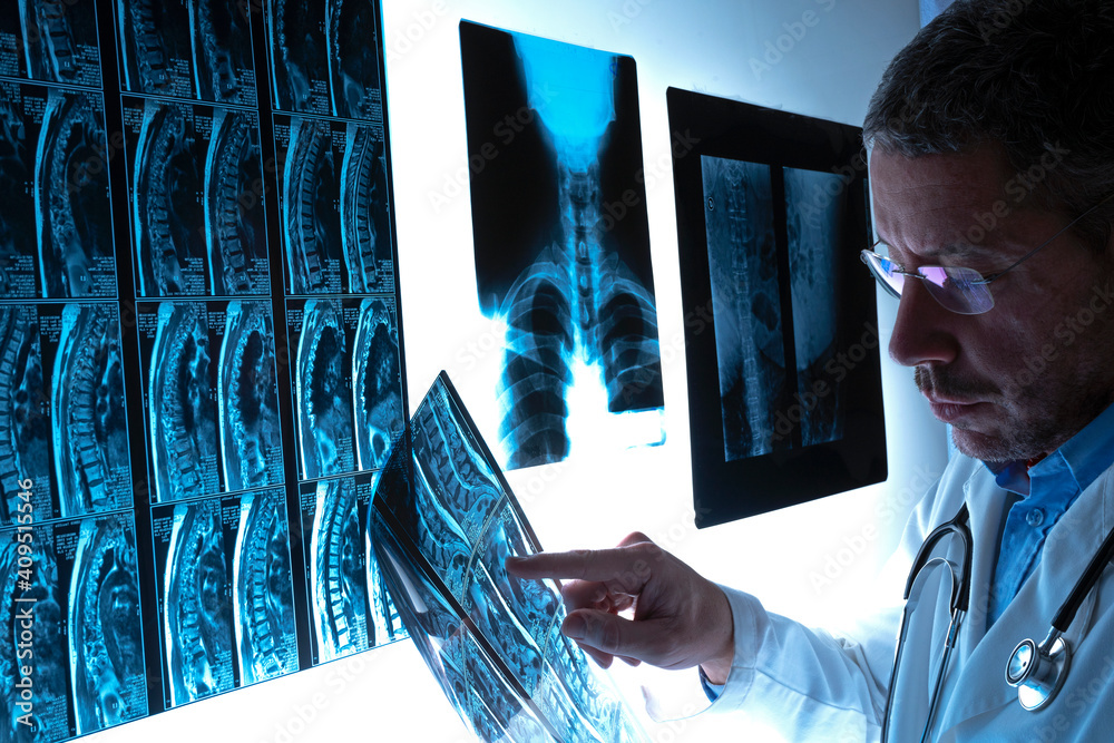 Radiologist examining spinal column by radiography, x-ray and magnetic ...