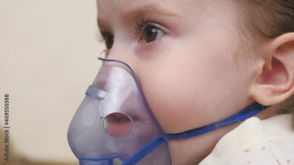 A cute baby in a mask is breathing through an inhaler. Home inhalation ...