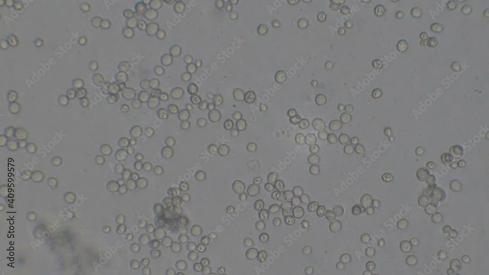 Microscopy of yeast cells (Saccharomyces cerevisiae). Monochrome ...