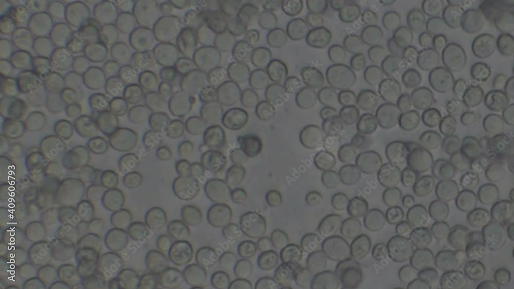 Microscopy of yeast cells (Saccharomyces cerevisiae). Monochrome ...