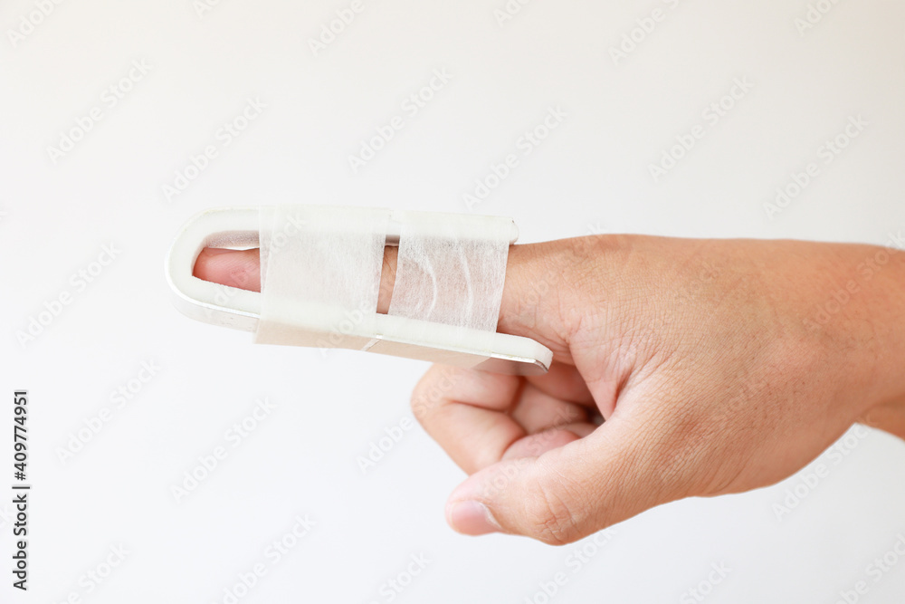 Finger injuries,finger splint, finger straight with orthopedic device ...