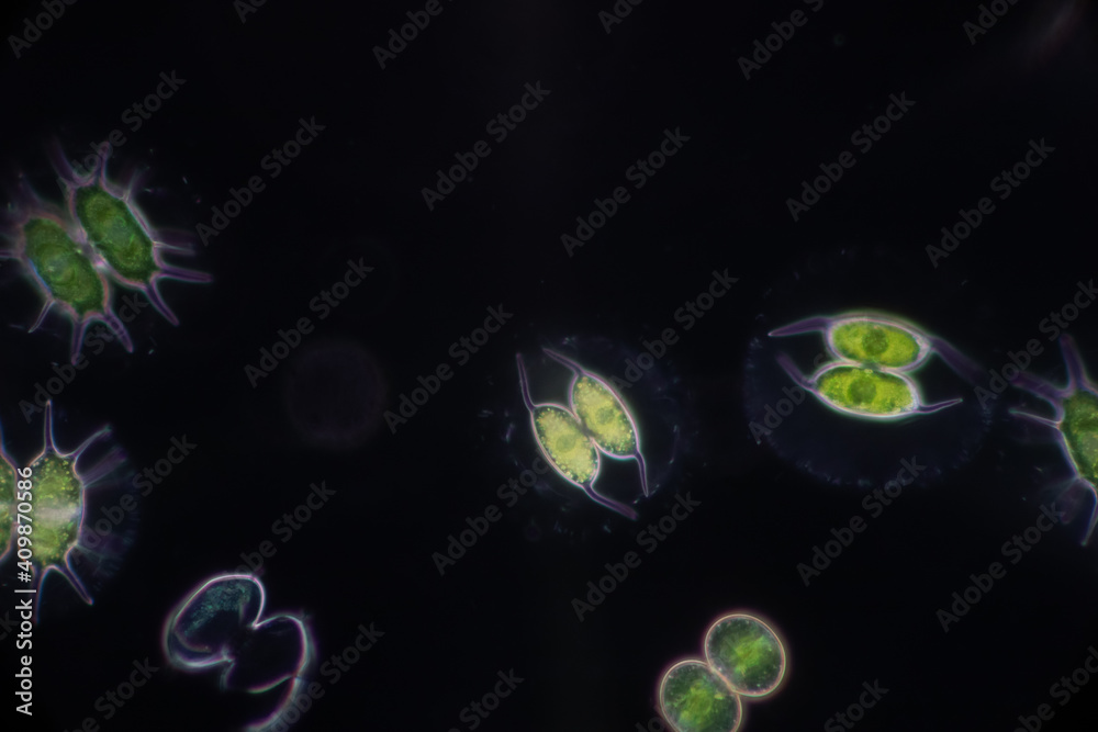 Protozoa and Green Algae in waste water under the microscope. Stock ...