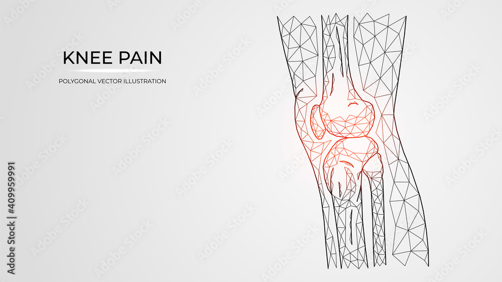 Polygonal vector illustration of pain, inflammation or injury in the ...
