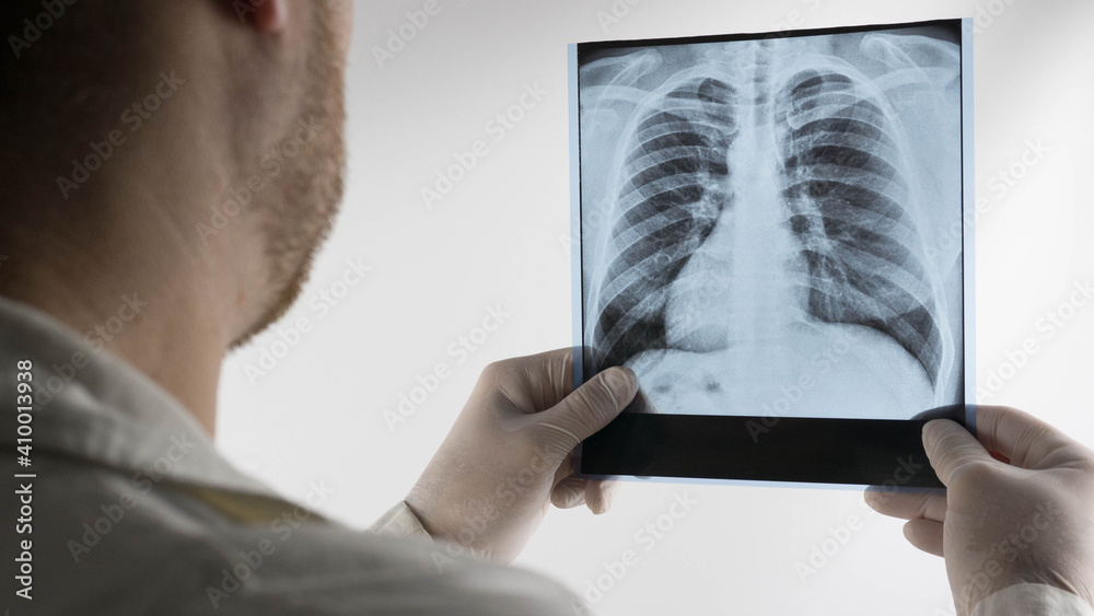 X-ray of the human lungs on an abel background, respiratory disease, a ...