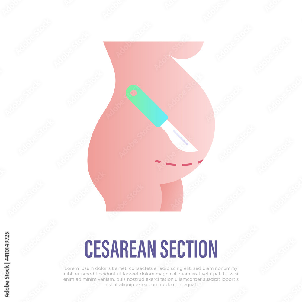 Cesarean section thin line icon. Scalpel near belly. Surgical operation for childbirth. Vector ...