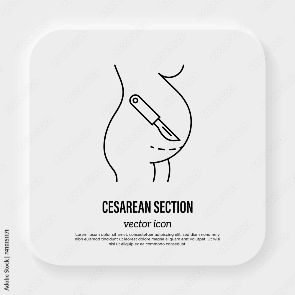 Cesarean section thin line icon. Scalpel near belly. Surgical operation ...