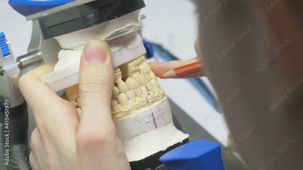 The dentist makes marks on the bite, denture, artificial jaw, denture ...