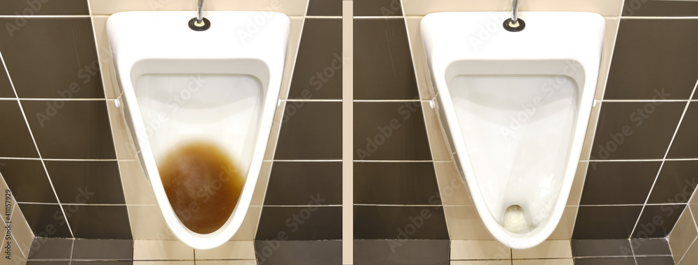 Blockage in the toilet urinal before and after fixing the problem ...